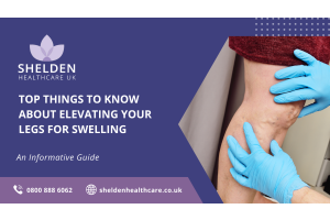 How Long to Elevate Legs to Reduce Swelling - Updated Guide